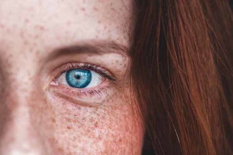 Red Skin? Here Are 3 Common Causes - Derma Made