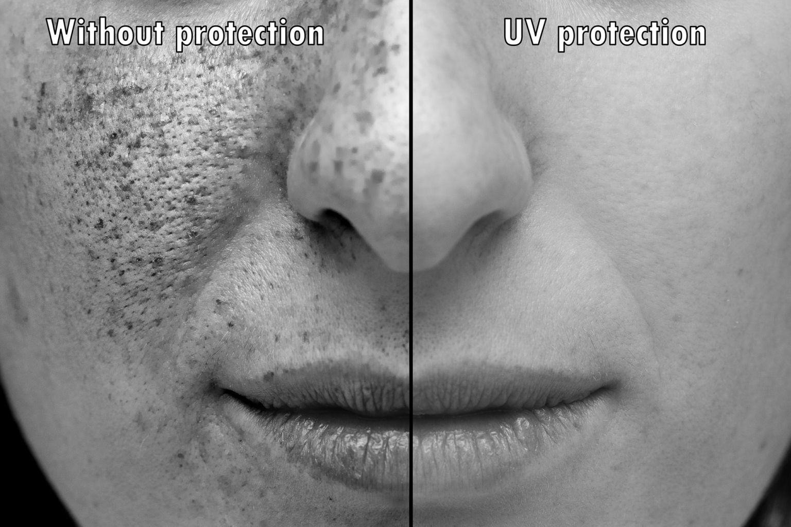 3 Signs Of Sun Damaged Skin How To Reverse It Derma Made